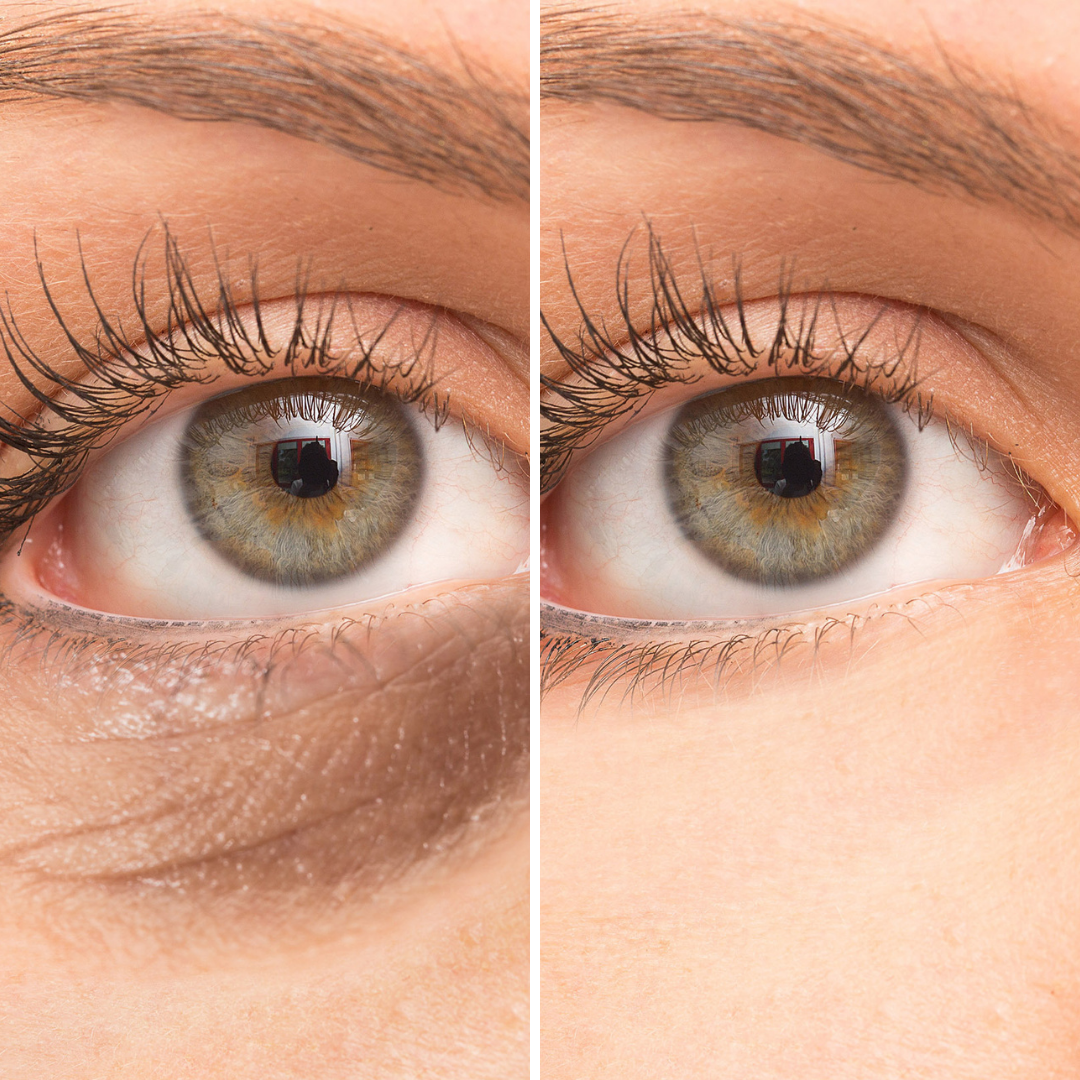 LUMIN EYE – konsentrert serum for mørke ringer